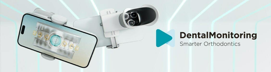 DentalMonitoring Announces Integration with Cloud Based Practice Management System and Retainer ...