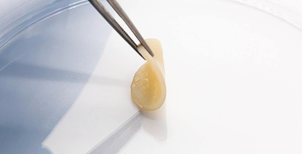 ALLOSOURCE ANNOUNCES FIRST PATIENT IMPLANTATION IN UNITED KINGDOM ...