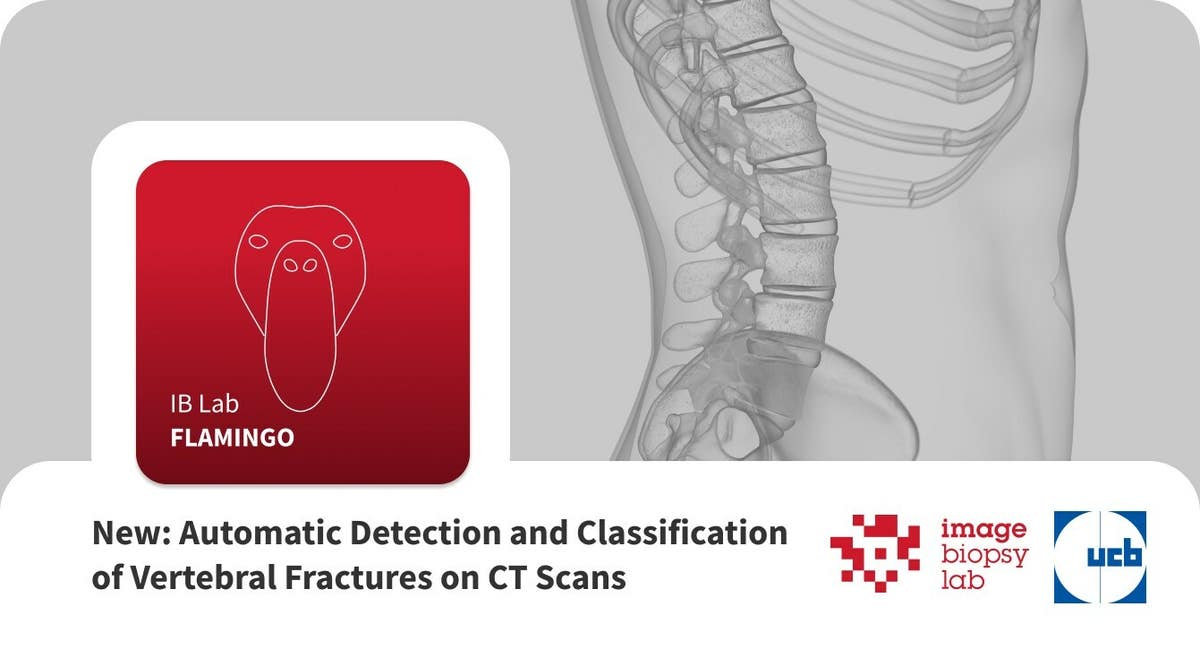 Ai Innovation For Automated Detection And Classification Of