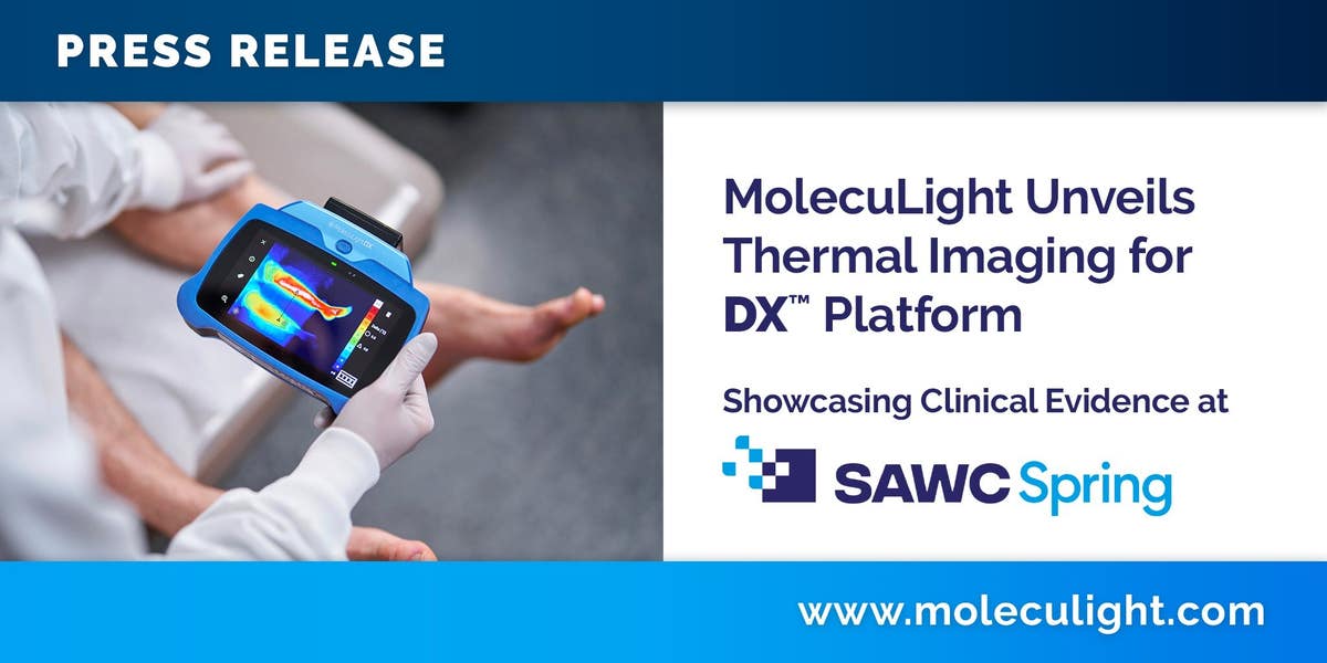 MolecuLight Unveils Thermal Imaging for DX™ Platform, Delivering Measurement, Bacterial ...