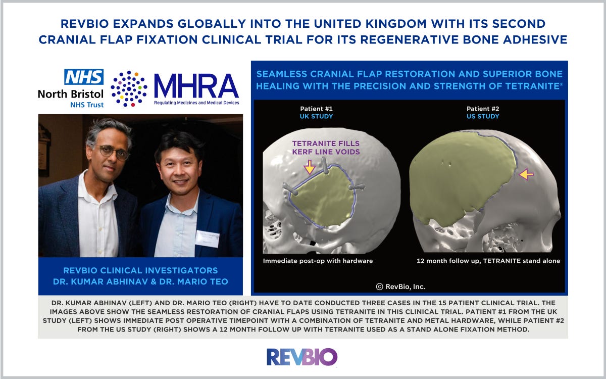 RevBio Expands Globally into the United Kingdom with its Second Cranial ...