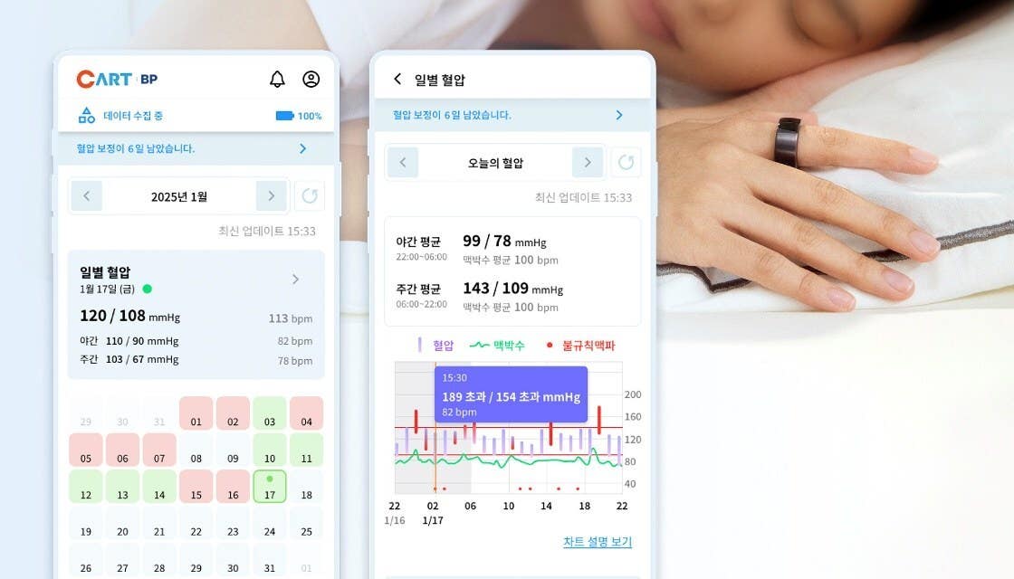 Sky Labs Launches CART BP, a Ring-Type Cuffless Blood Pressure Monitor